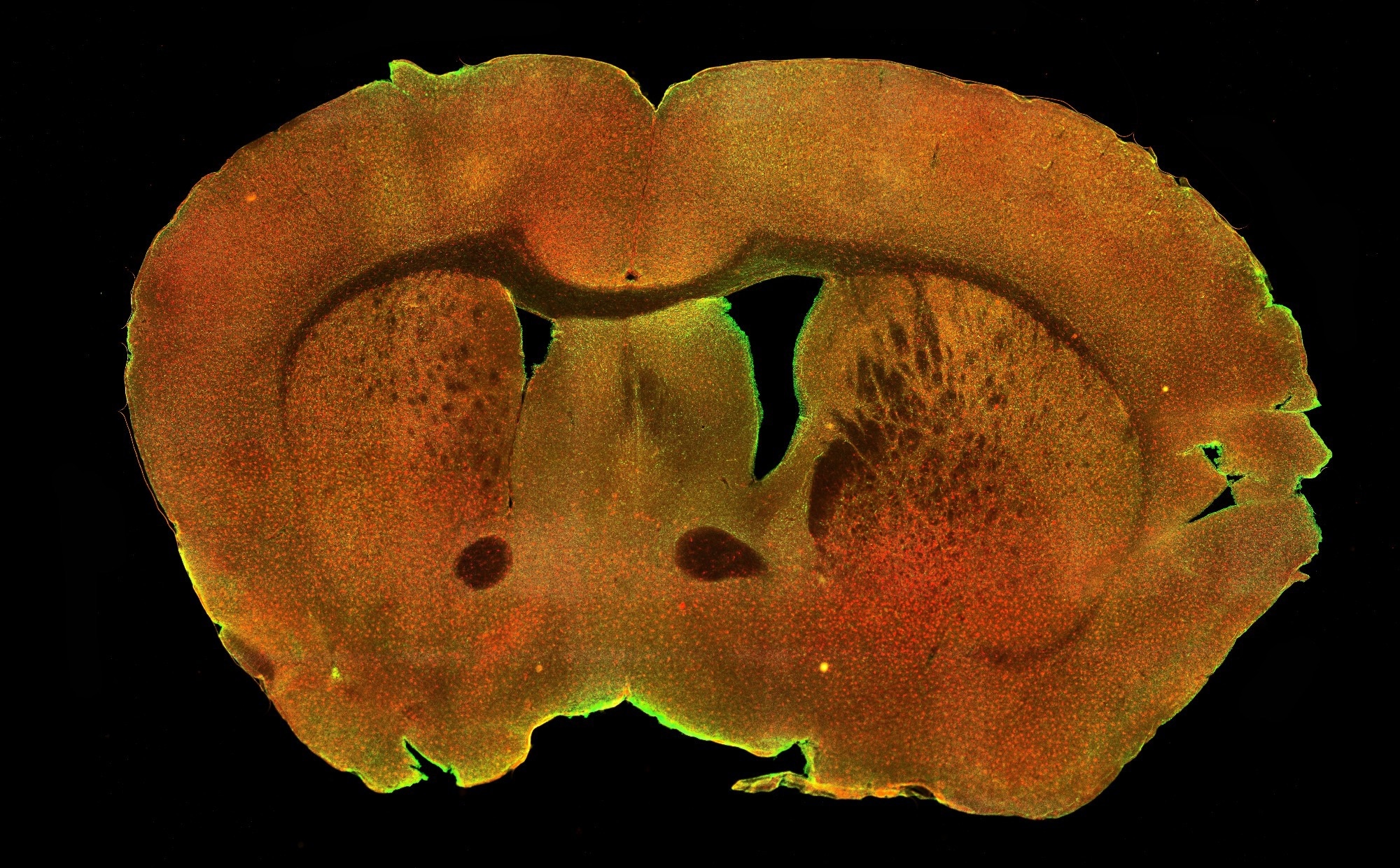 Two-Photon Imaging Reveals Brain Mitophagy Decline